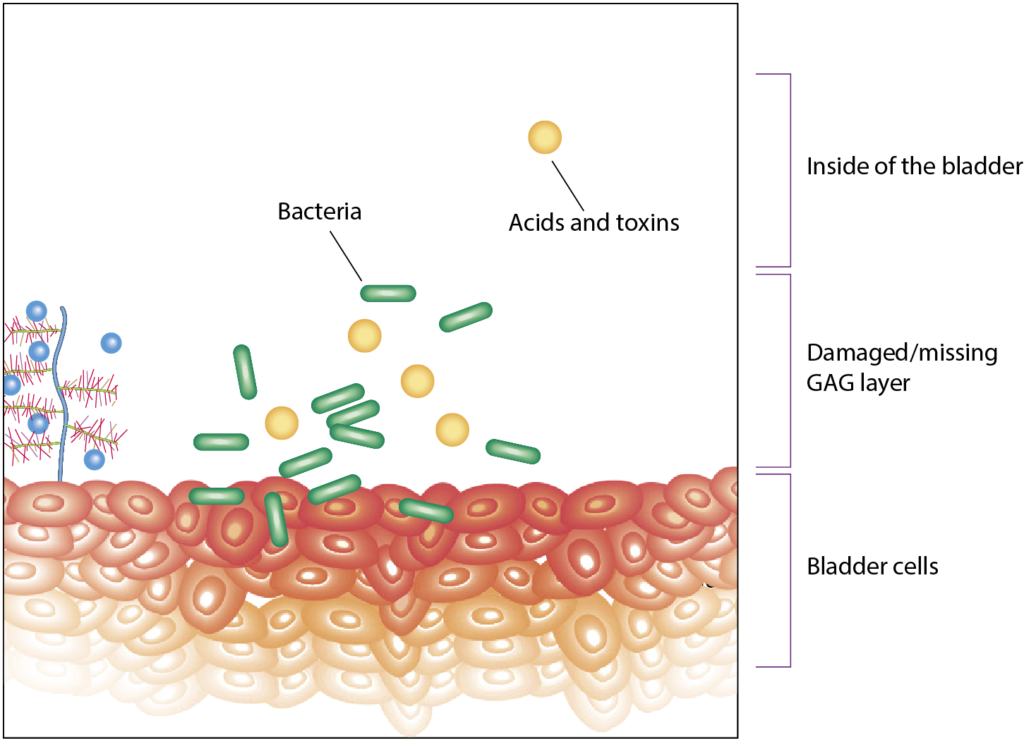About – Patient – iAluRil