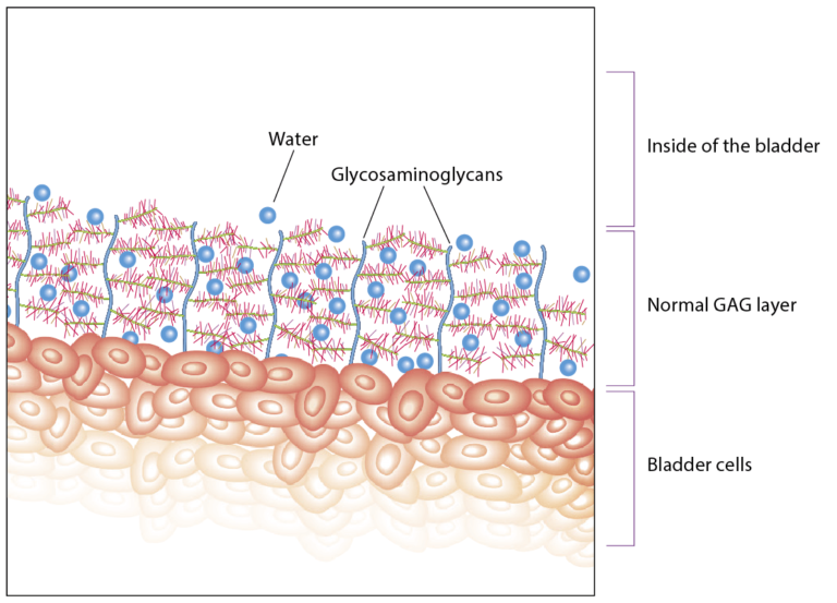 About – Patient – iAluRil