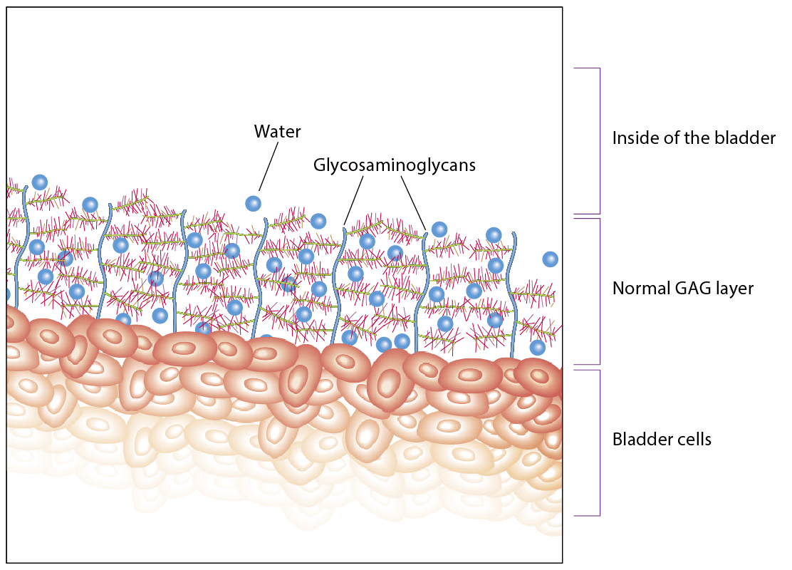 About – Patient – iAluRil
